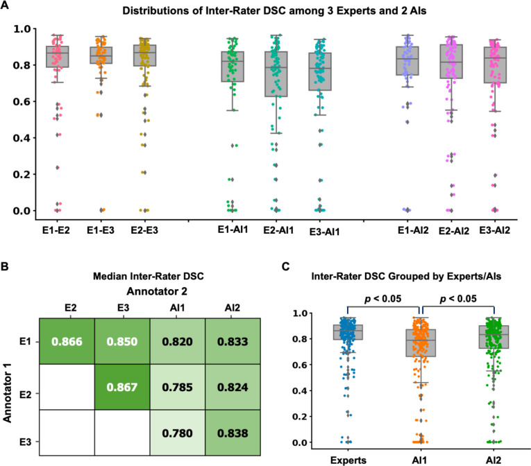 Expert-level pediatric brain tumor segmentation in a limited data ...