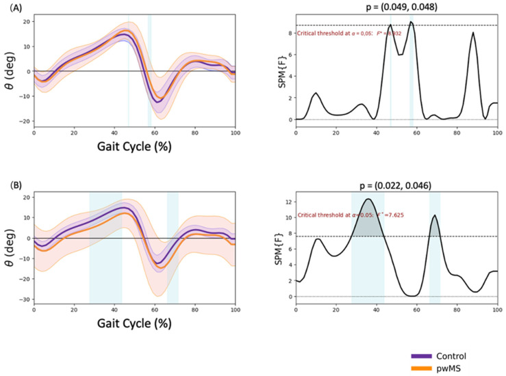 Kinematic Gait Analysis in People with Mild-Disability Multiple ...