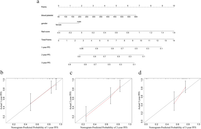 Development and validation of a [18F]FDG PET/CT-based radiomics nomogram to predict the ...