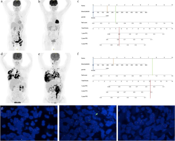 Development and validation of a [18F]FDG PET/CT-based radiomics nomogram to predict the ...
