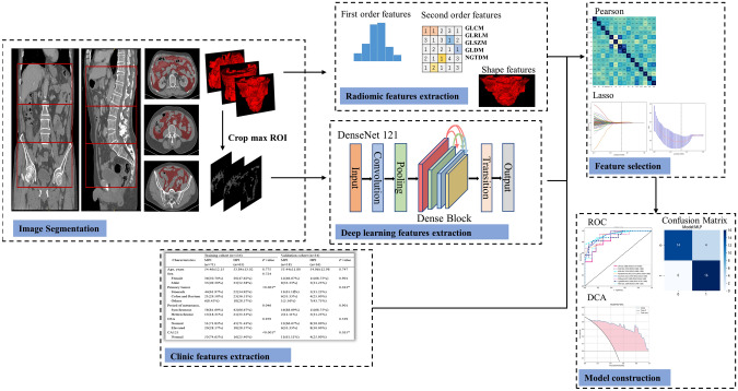 CT-based deep learning model: a novel approach to the preoperative ...
