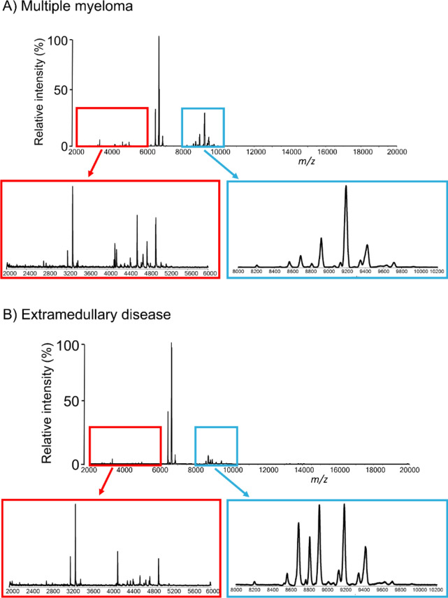 Liquid biopsy of peripheral blood using mass spectrometry detects primary extramedullary disease ...