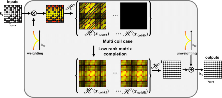 Compressed sensing MRI: a review from signal processing perspective - PMC