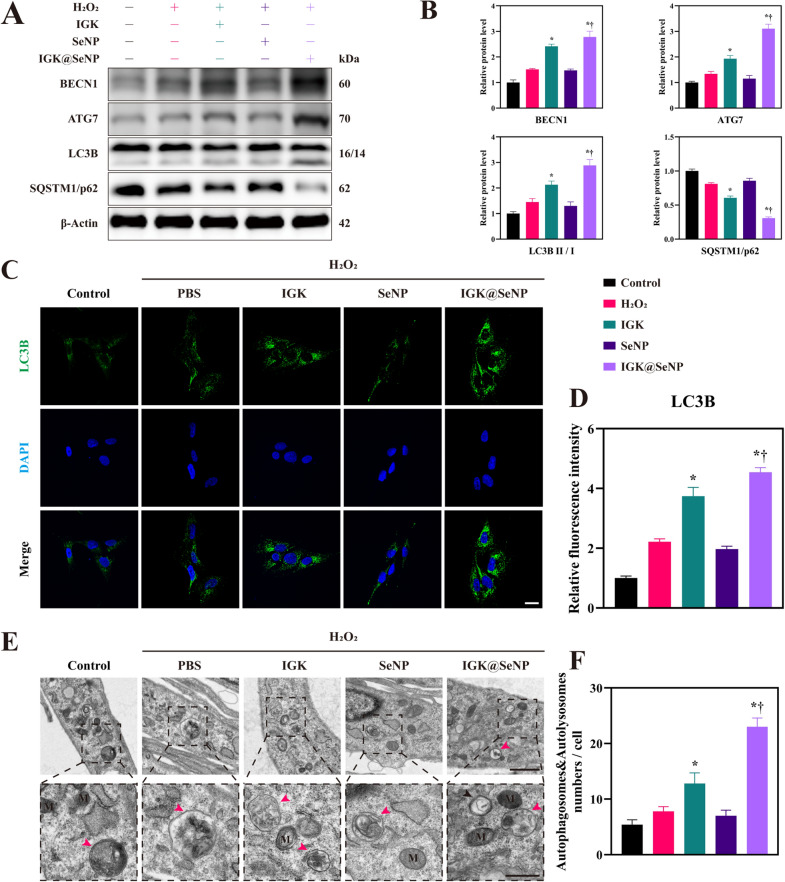 Isoginkgetin-loaded reactive oxygen species scavenging nanoparticles ameliorate intervertebral ...