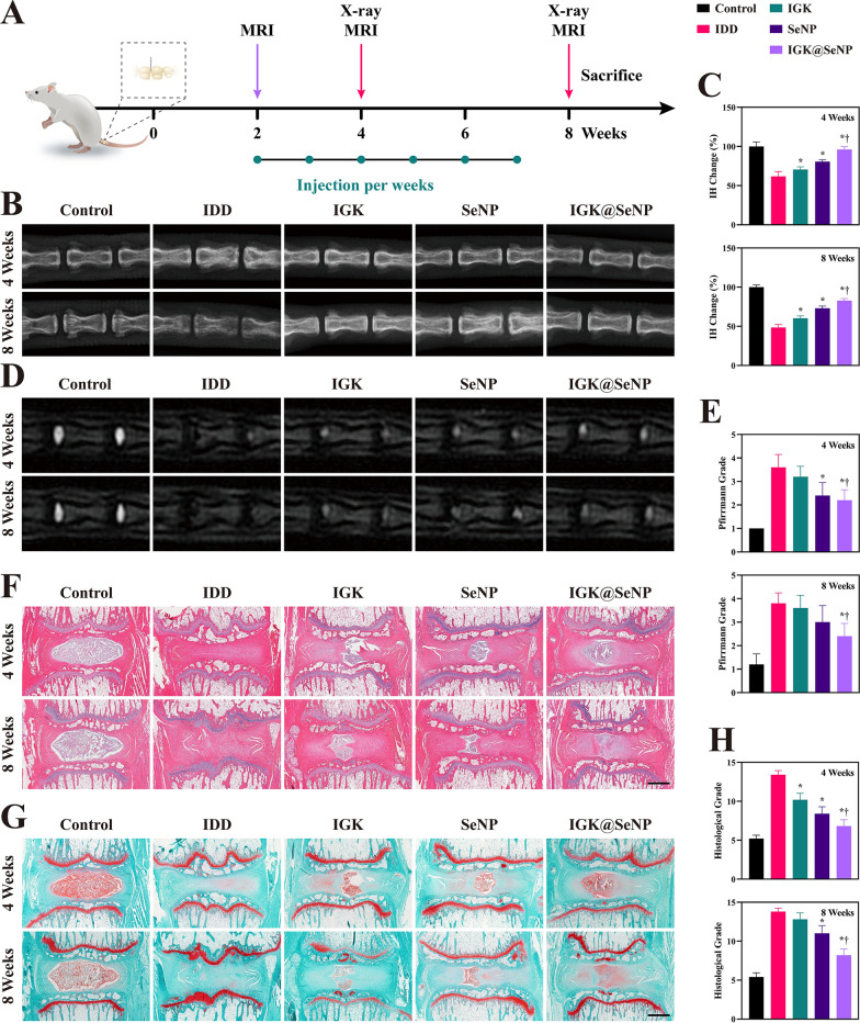 Isoginkgetin-loaded reactive oxygen species scavenging nanoparticles ameliorate intervertebral ...