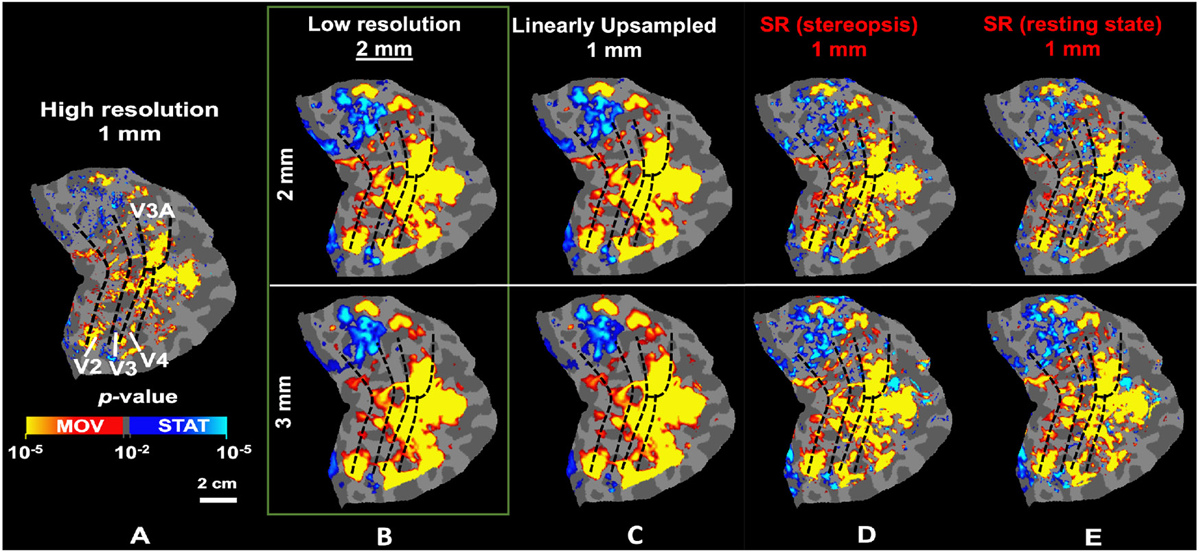 RESOLUTION- AND STIMULUS-AGNOSTIC SUPER-RESOLUTION OF ULTRA-HIGH-FIELD ...