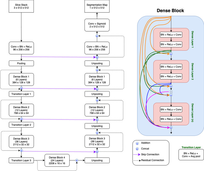 Automatic kidney segmentation using 2.5D ResUNet and 2.5D DenseUNet for ...