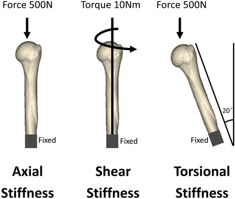 Biomechanical evaluation of a novel dualplate fixation method for ...