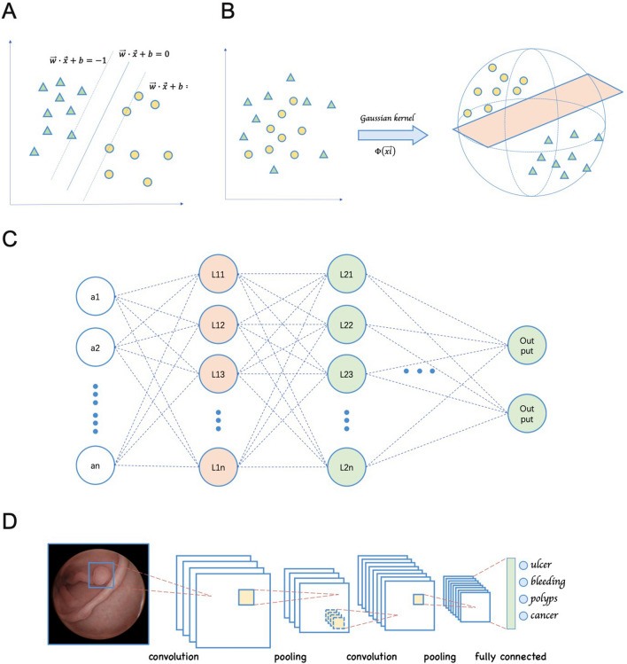 Convolution neural network for the diagnosis of wireless capsule endoscopy: a systematic review ...