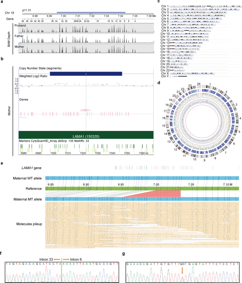 Identification of a likely pathogenic structural variation in the LAMA1 gene by Bionano optical ...