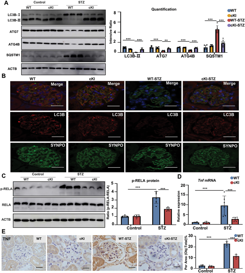 Circ-0000953 deficiency exacerbates podocyte injury and autophagy ... Circ-0000953 deficiency exacerbates podocyte injury and autophagy ...