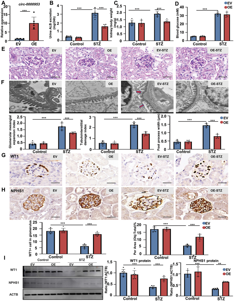 Circ-0000953 deficiency exacerbates podocyte injury and autophagy ... Circ-0000953 deficiency exacerbates podocyte injury and autophagy ...