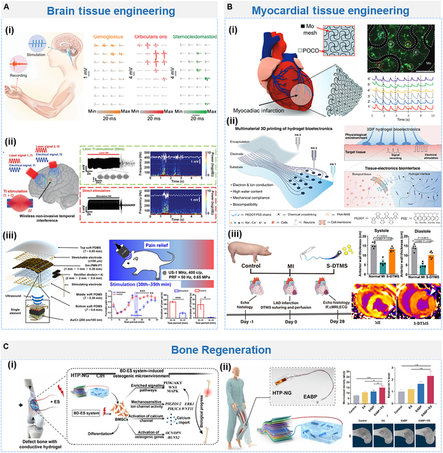 Recent Progress of Soft and Bioactive Materials in Flexible Bioelectronics - PMC