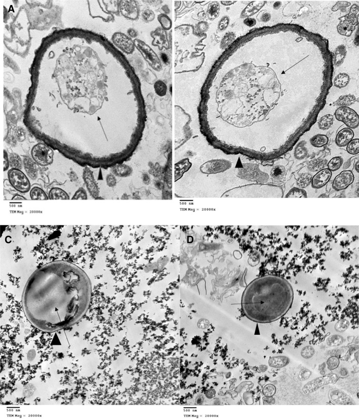 The impact of vinegar on pathogenic Acanthamoeba astronyxis isolate - PMC The impact of vinegar on pathogenic Acanthamoeba astronyxis isolate - PMC