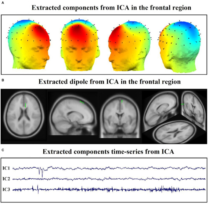 Machine learning approaches and non-linear processing of extracted components in frontal region ...