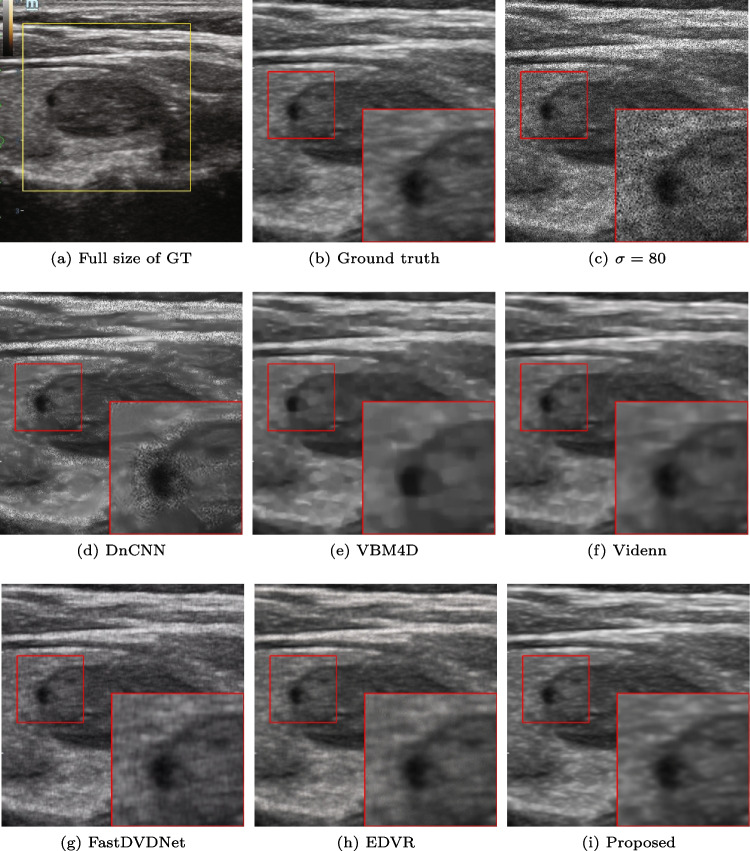 DSTAN: A Deformable Spatial-temporal Attention Network with Bidirectional Sequence Feature ...