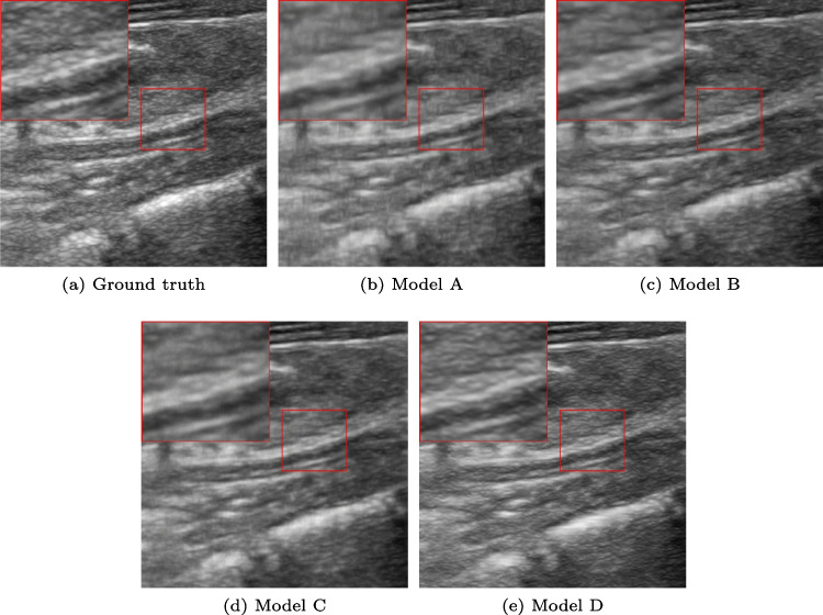 DSTAN: A Deformable Spatial-temporal Attention Network with Bidirectional Sequence Feature ...