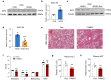 Metabolic crosstalk between skeletal muscle cells and liver through IRF4-FSTL1 in nonalcoholic ...