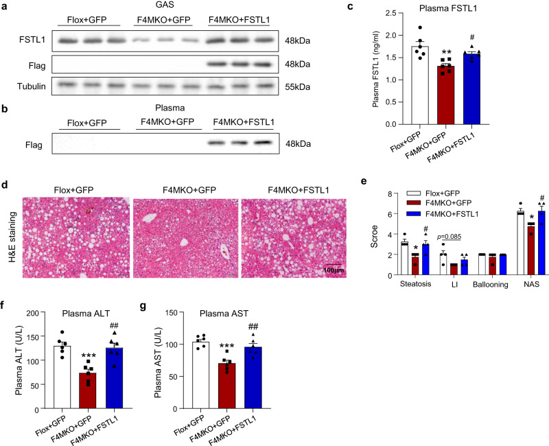 Metabolic crosstalk between skeletal muscle cells and liver through IRF4-FSTL1 in nonalcoholic ...