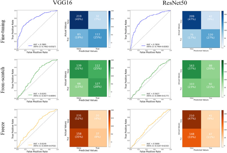 Automatic detection and visualization of temporomandibular joint effusion with deep neural ...
