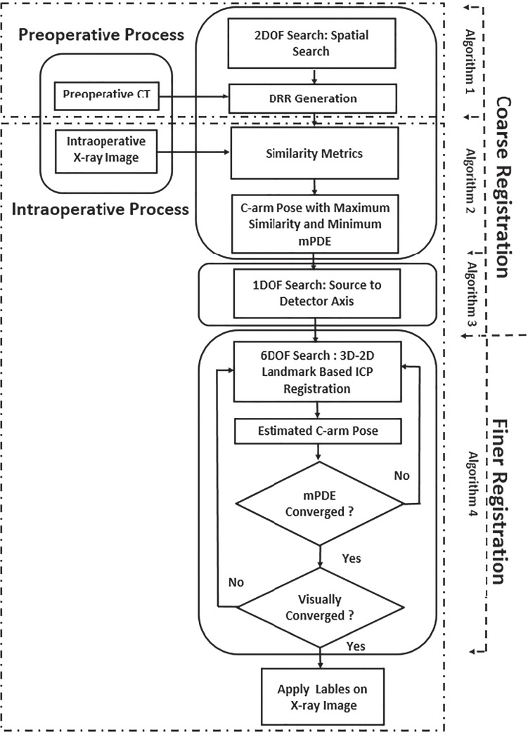Realistic C-arm to pCT registration for vertebral localization in spine surgery: A hybrid 3D-2D ...