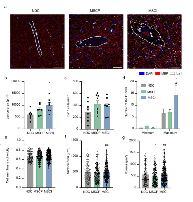 Microglia and Immune cells interactions in multiple sclerosis cognitive impairment: a postmortem ...