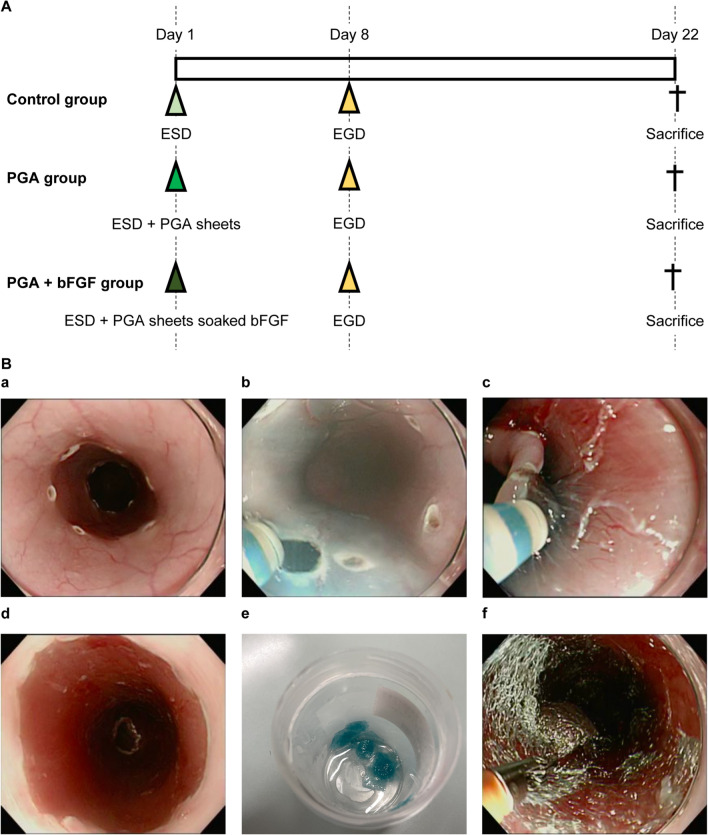 Application of polyglycolic acid sheets and basic fibroblast growth factor to prevent esophageal ...