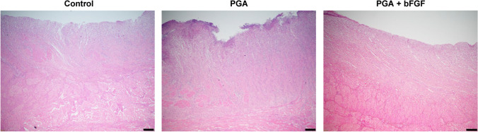 Application of polyglycolic acid sheets and basic fibroblast growth factor to prevent esophageal ...