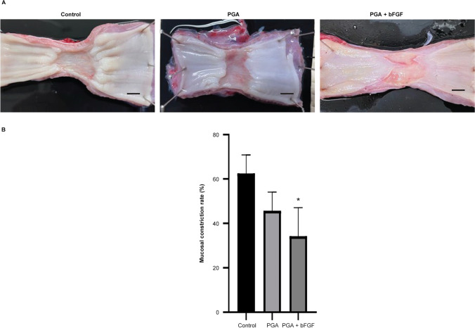 Application of polyglycolic acid sheets and basic fibroblast growth factor to prevent esophageal ...
