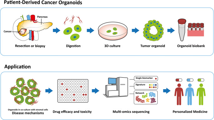 Organoid technology for personalized pancreatic cancer therapy - PMC