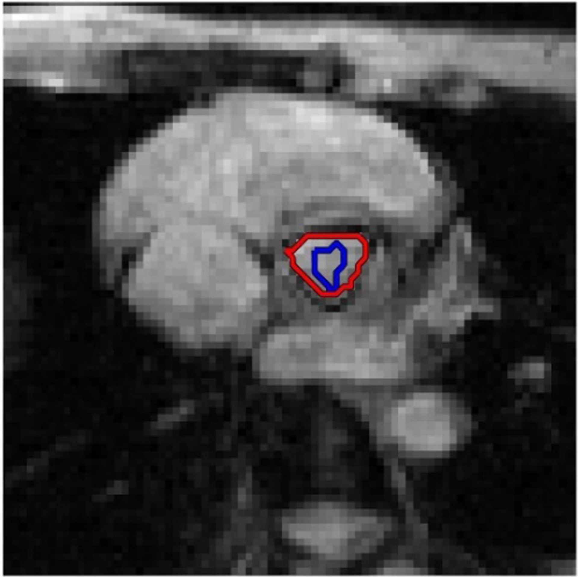Visualization of Human Aortic Valve Dynamics Using MRI with Sub-Millisecond Temporal Resolution ...