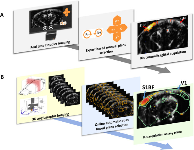 A functional ultrasound brain GPS for automatic vascular-based neuronavigation - PMC