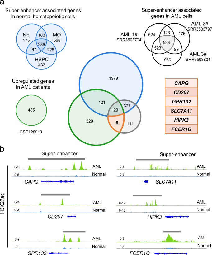 Super-enhancer-associated gene CAPG promotes AML progression - PMC