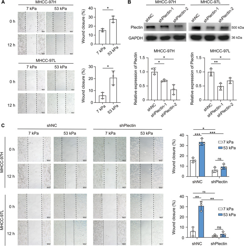 High matrix stiffness accelerates migration of hepatocellular carcinoma ...