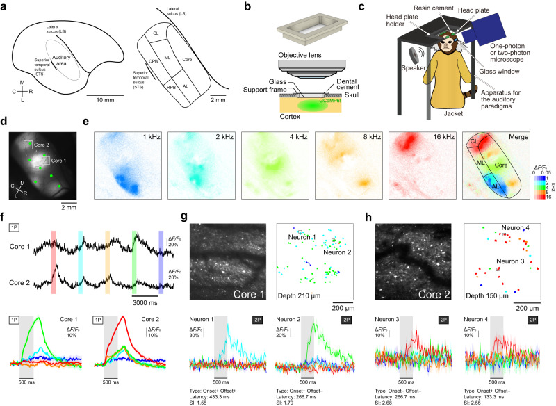 Change detection in the primate auditory cortex through feedback of prediction error signals - PMC