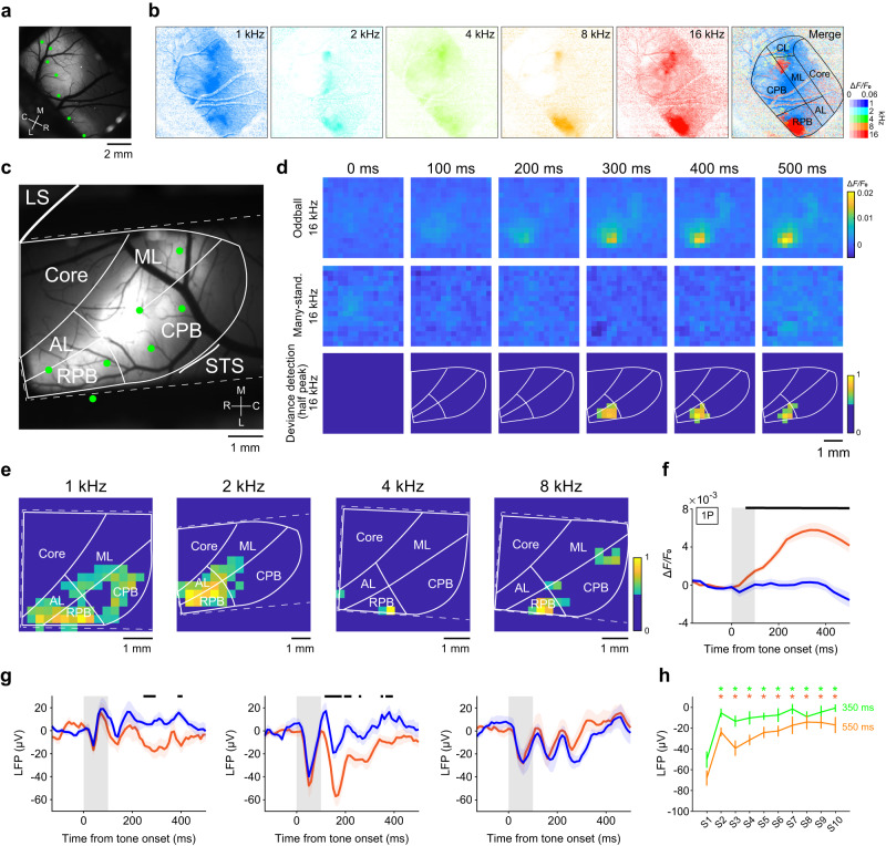 Change detection in the primate auditory cortex through feedback of prediction error signals - PMC