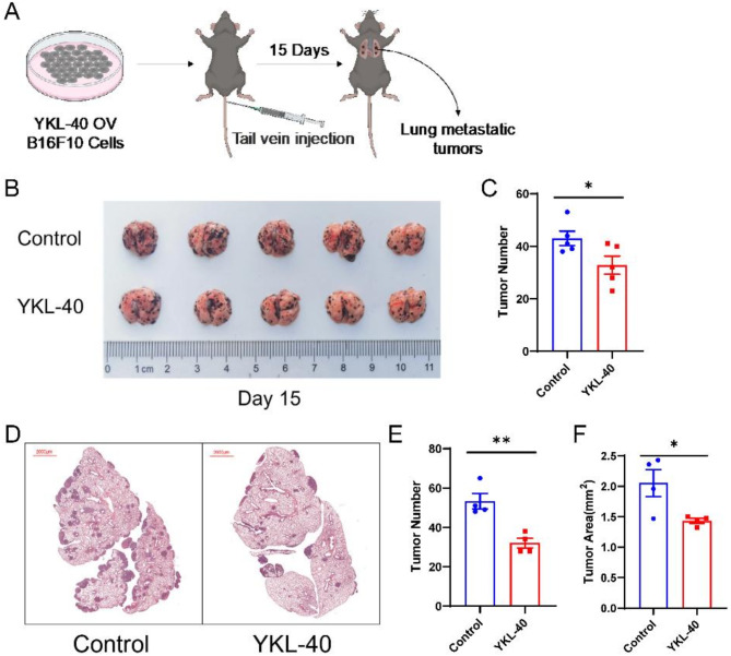 YKL-40 inhibits melanoma progression and metastasis by inducing immune cell infiltration in a ...