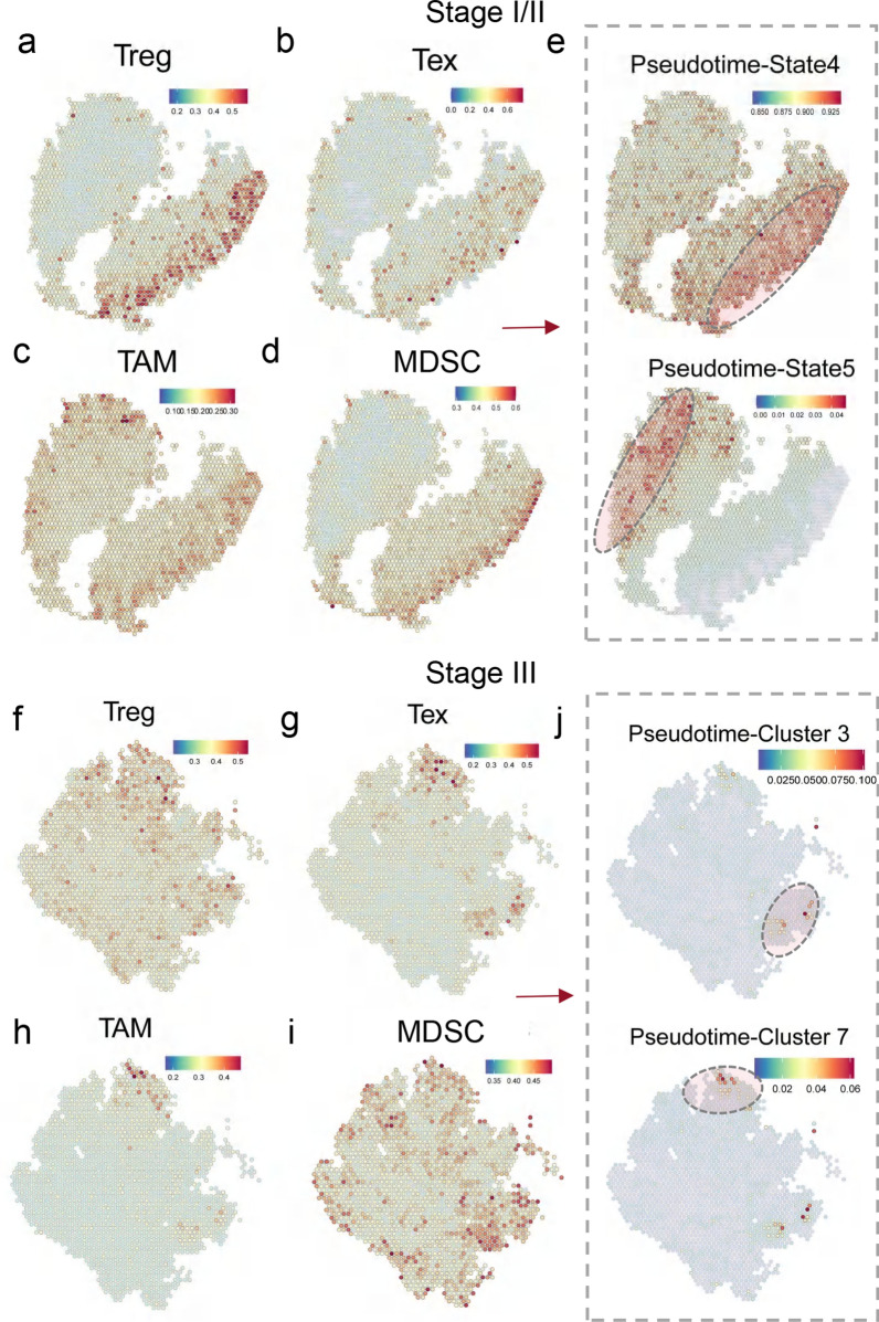 Unraveling temporal and spatial biomarkers of epithelial-mesenchymal transition in colorectal ...