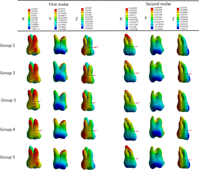 Three-dimensional finite element analysis of maxillary molar distalization treated with clear ...