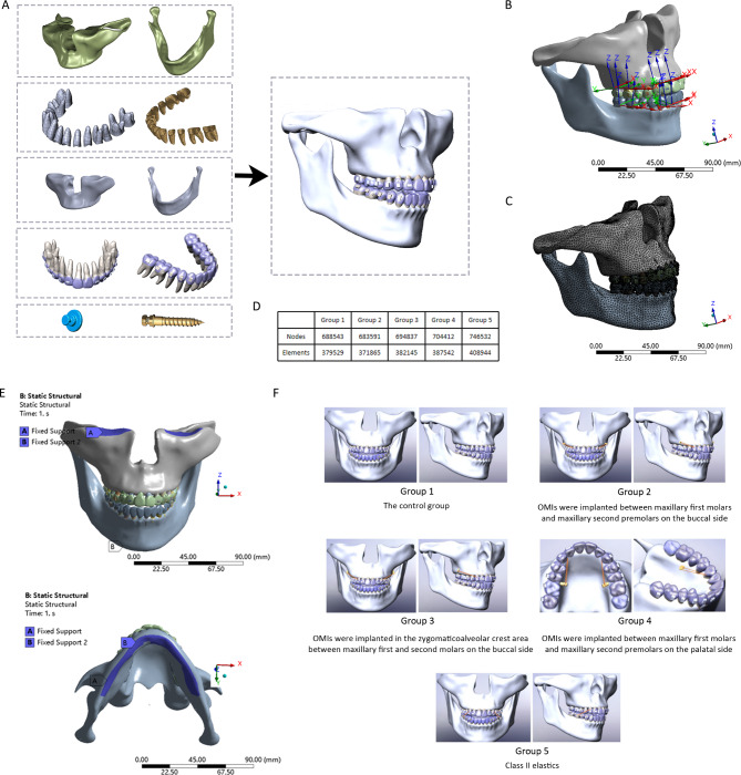 Three-dimensional finite element analysis of maxillary molar distalization treated with clear ...