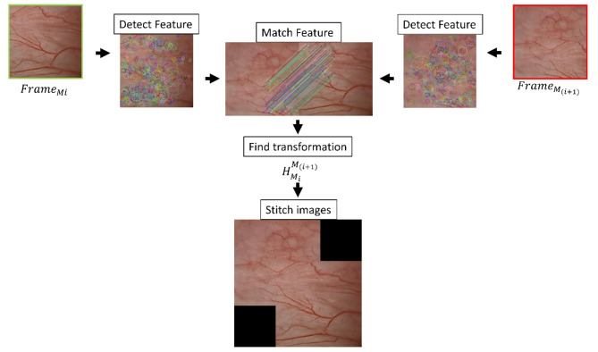 Bladder image stitching algorithm for navigation and referencing using a standard cystoscope - PMC