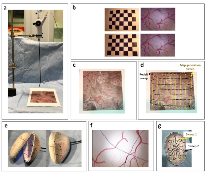 Bladder image stitching algorithm for navigation and referencing using a standard cystoscope - PMC