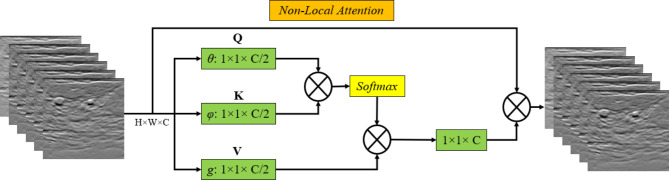 Explainable attention based breast tumor segmentation using a combination of UNet, ResNet ...