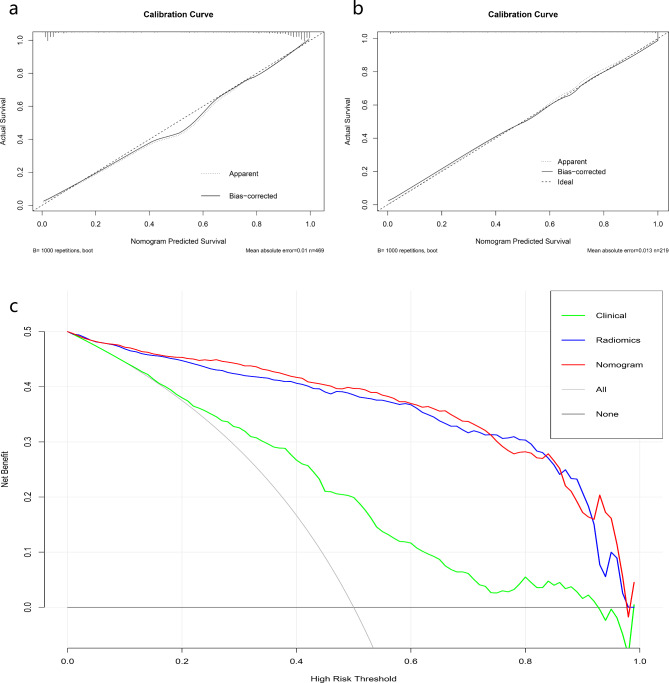 CT-based deep learning radiomics nomogram for the prediction of pathological grade in bladder ...
