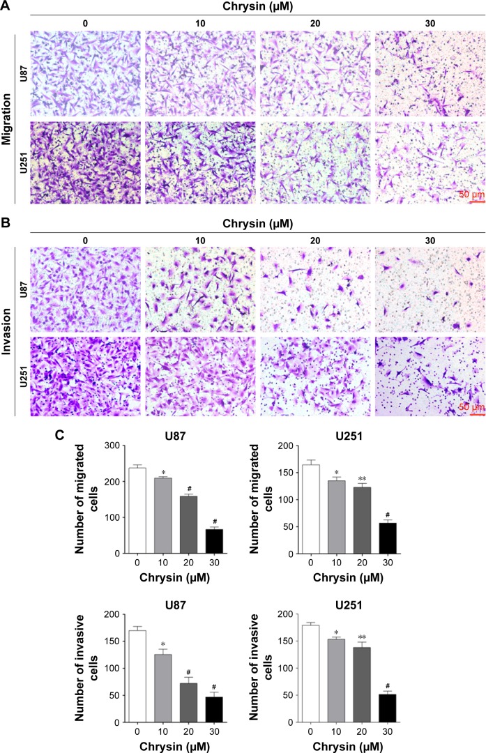 Chrysin suppresses proliferation, migration, and invasion in glioblastoma cell lines via ...