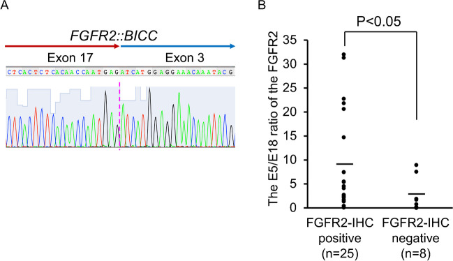 Expression of fibroblast growth factor receptor 2 (FGFR2) in combined hepatocellular ...