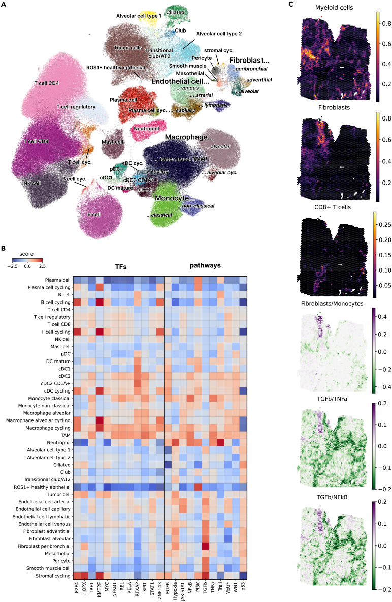 Multimodal analysis unveils tumor microenvironment heterogeneity linked to immune activity and ...