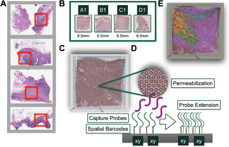 Inferring spatial transcriptomics markers from whole slide images to ...