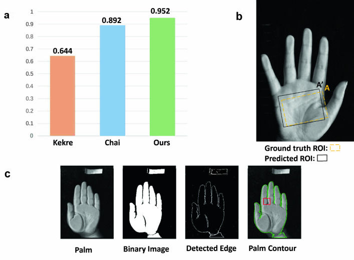 Palmprint Phenotype Feature Extraction and Classification Based on Deep Learning - PMC