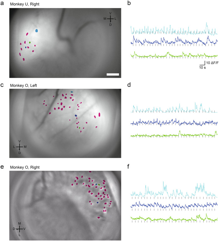 Microendoscopic calcium imaging of the primary visual cortex of behaving macaques - PMC